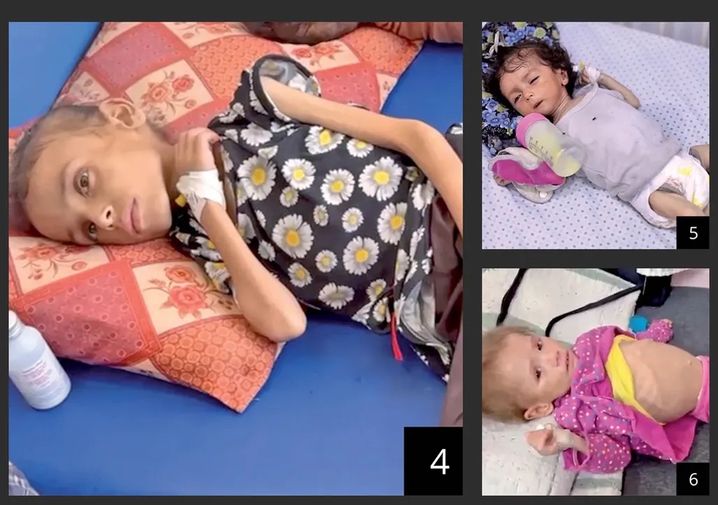 Starvation Is Everywhere’: Virtual Tours of Gaza Clinics Expose the ...